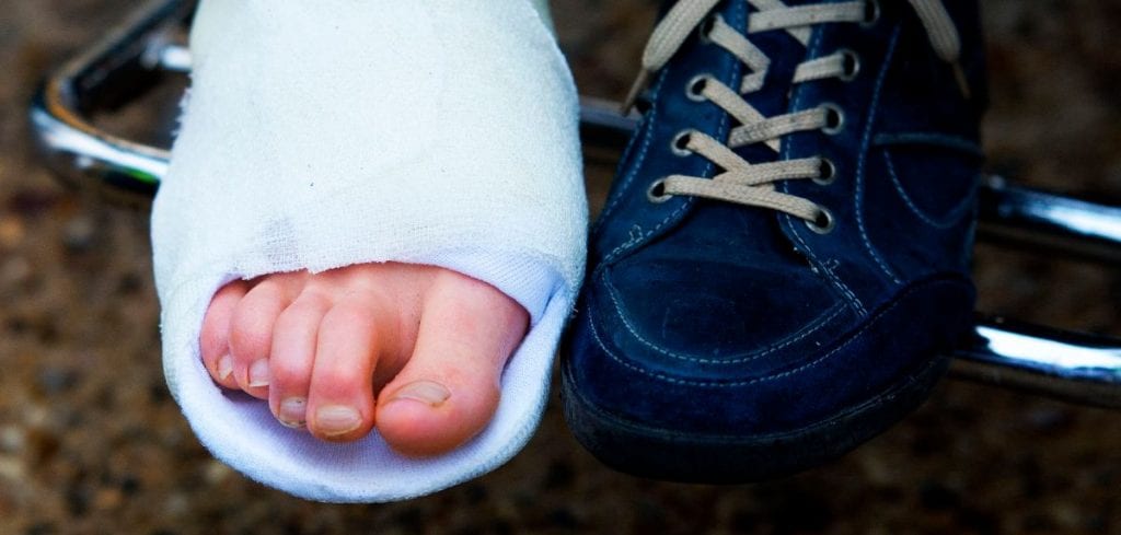 Gezocht: dief met been in gips die het op een lopen zette - indebuurt ...