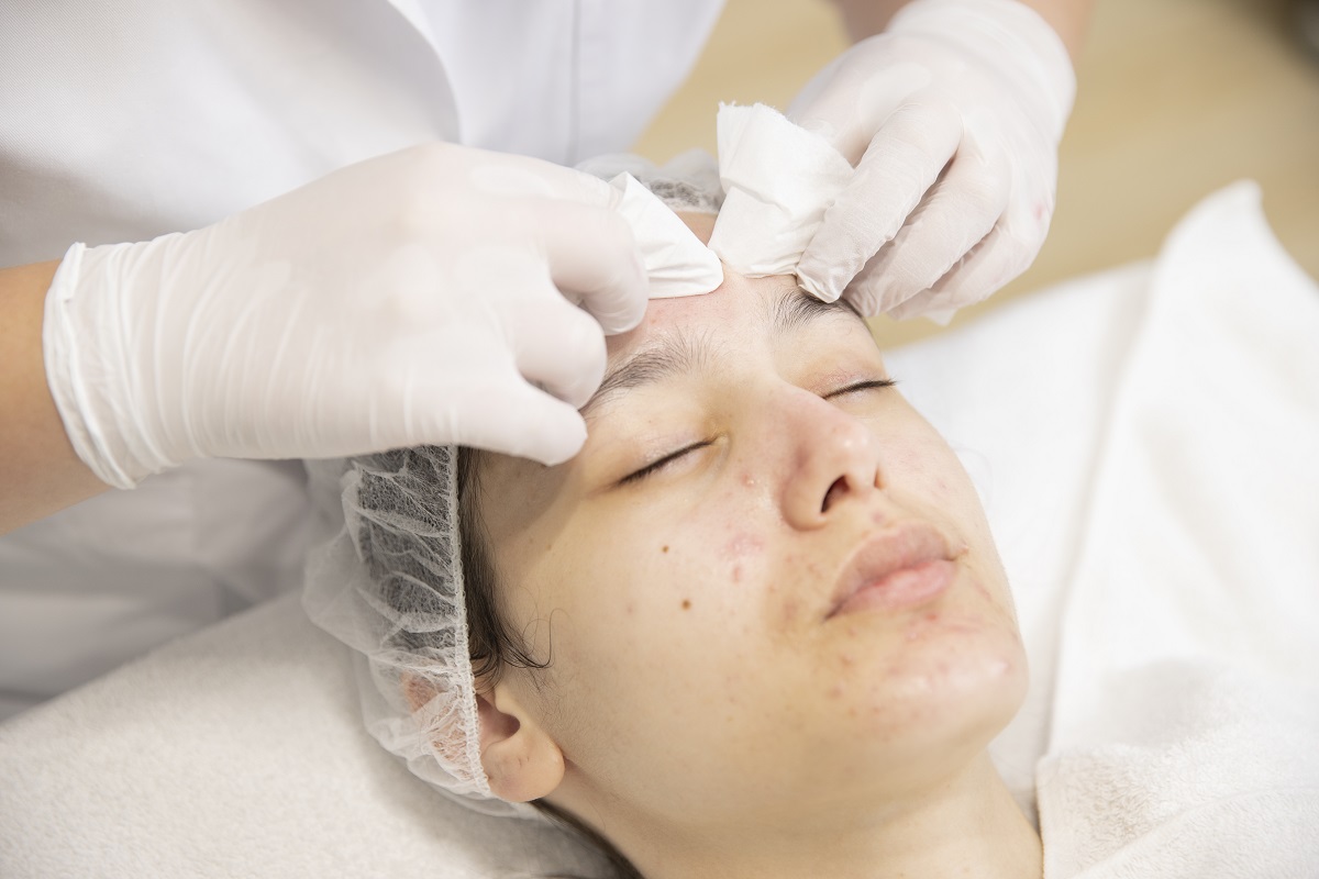 Bij Huidzorg 073 behandelen ze acne én acnelittekens: 'Wij zijn pas ...