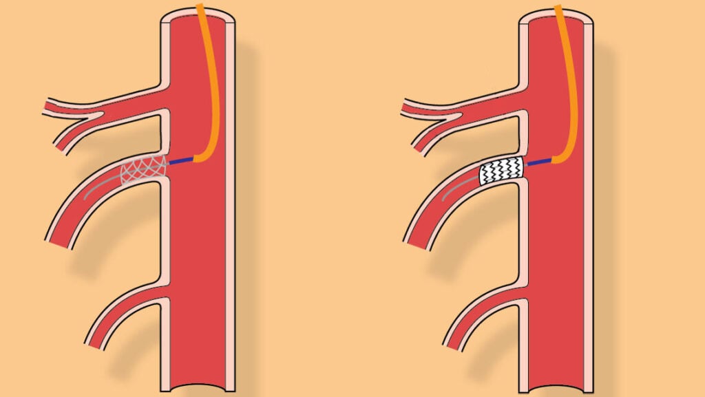 Desirée en haar collega's helpen bij deze zeldzame ziekte: 'Zo maken we ...